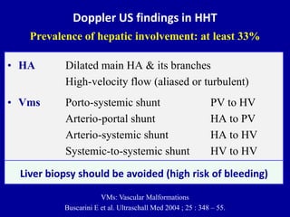 Doppler ultrasound of the liver in hereditary hemorrhagic ...