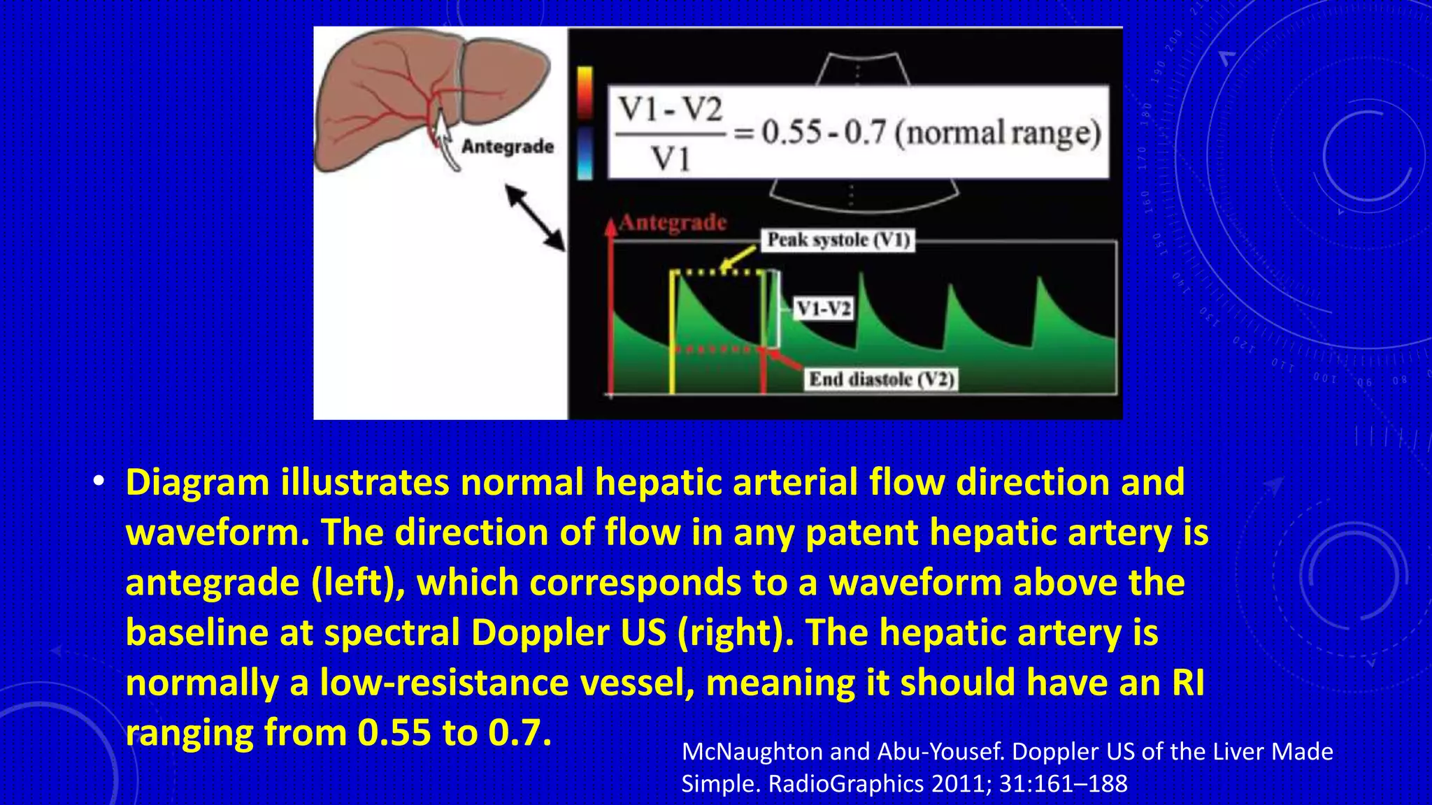 Doppler us of liver made simple Dr. Muhammad Bin Zulfiqar | PPTX
