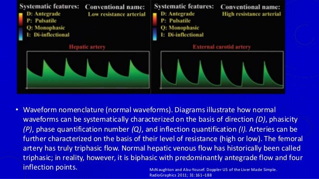 Doppler us of liver made simple Dr. Muhammad Bin Zulfiqar