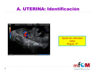 Cribado de placentación deficiente (CIR y preeclampsia) . Estudio ...