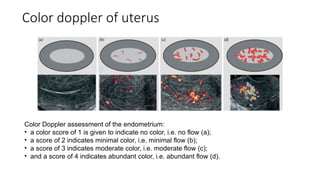 Doppler Uterine lectures in ultrasound.pptx