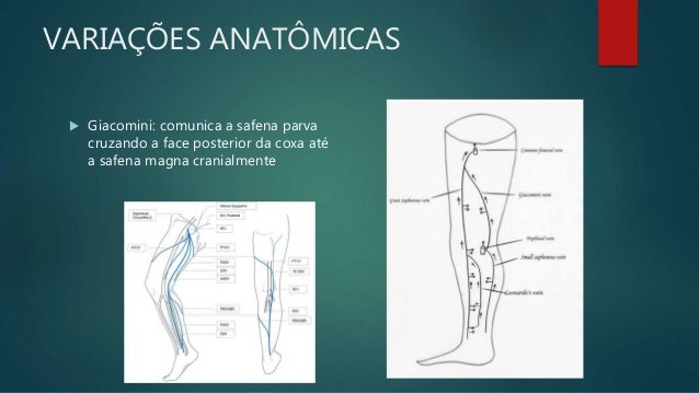 Doppler venoso membros inferiores