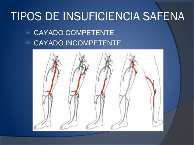 Dopple venosos tvp e insuficiencia