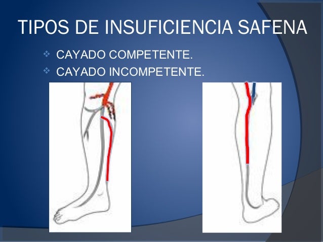 Dopple venosos tvp e insuficiencia