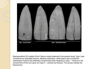 Do pre existing micro cracks play a role in the fracture resistance of ...