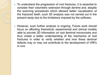 Do pre existing micro cracks play a role in the fracture resistance of ...