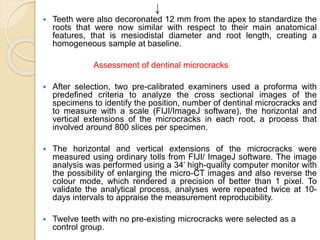 Do pre existing micro cracks play a role in the fracture resistance of ...