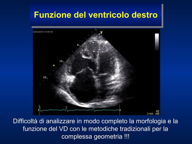 IMAGING DEL VENTRICOLO DESTRO CON RISONANZA MAGNETICA | PPT