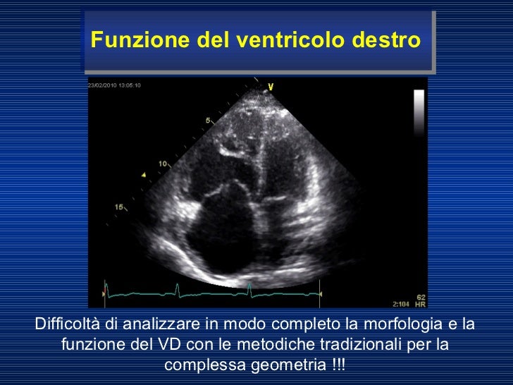 IMAGING DEL VENTRICOLO DESTRO CON RISONANZA MAGNETICA