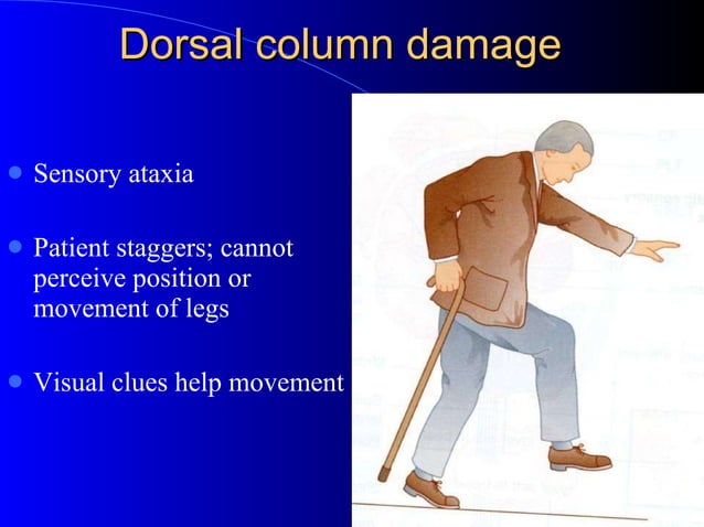 Dorsal column pathway