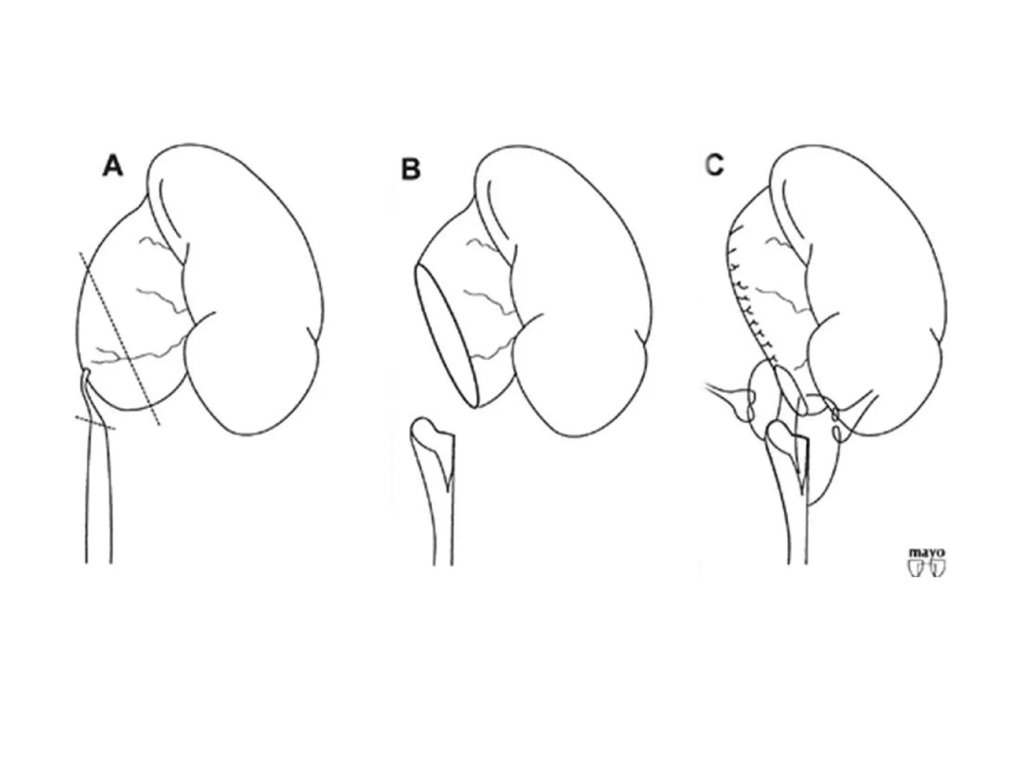 Dorsal Lumbotomy | PPT