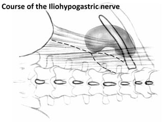 Dorsal Lumbotomy | PPT
