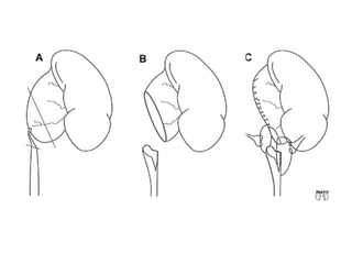 Dorsal Lumbotomy | PPT