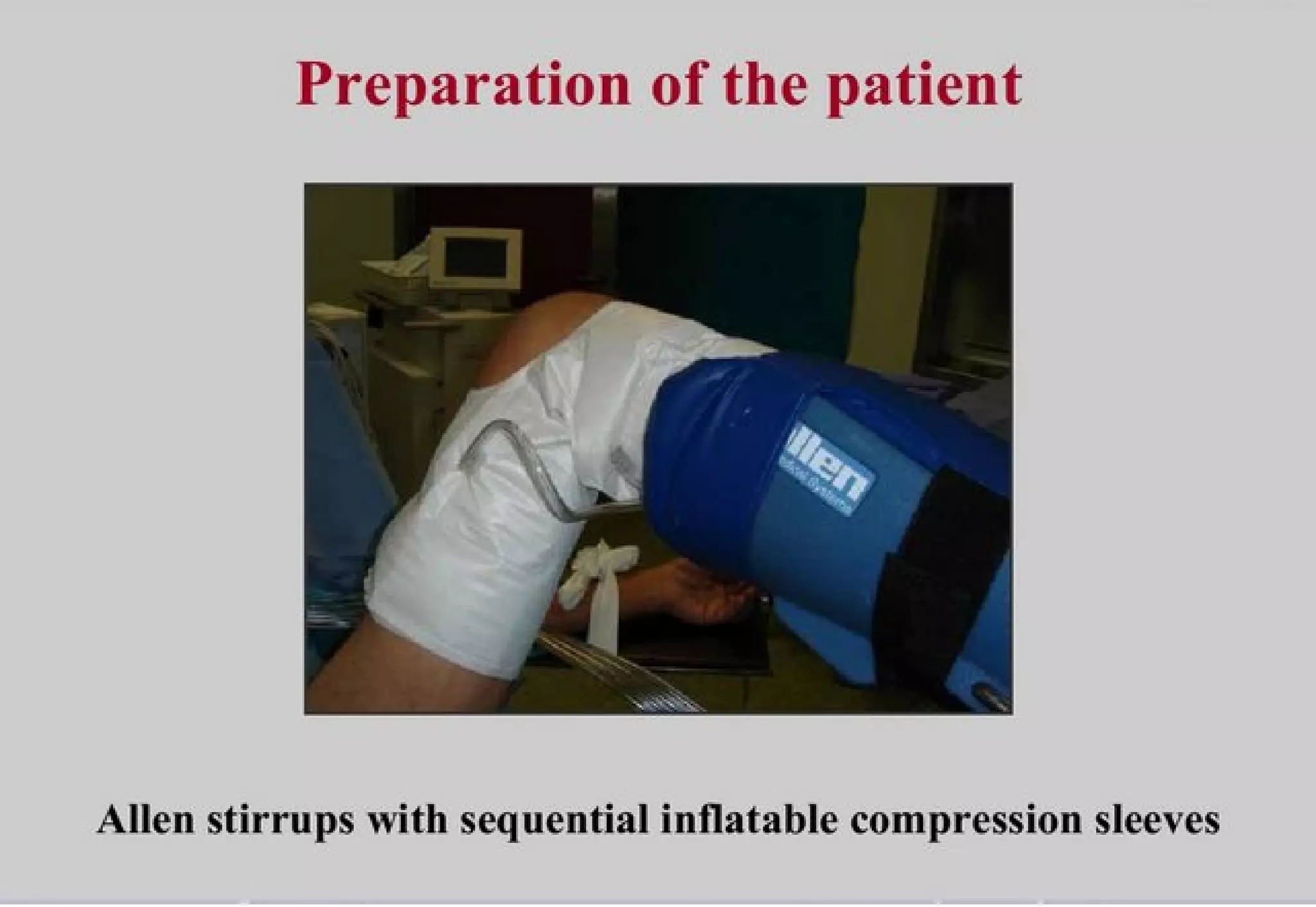 Dorsal oral mucosal onlay graft urethroplasty | PDF