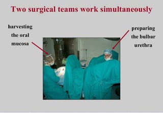 Dorsal oral mucosal onlay graft urethroplasty | PDF