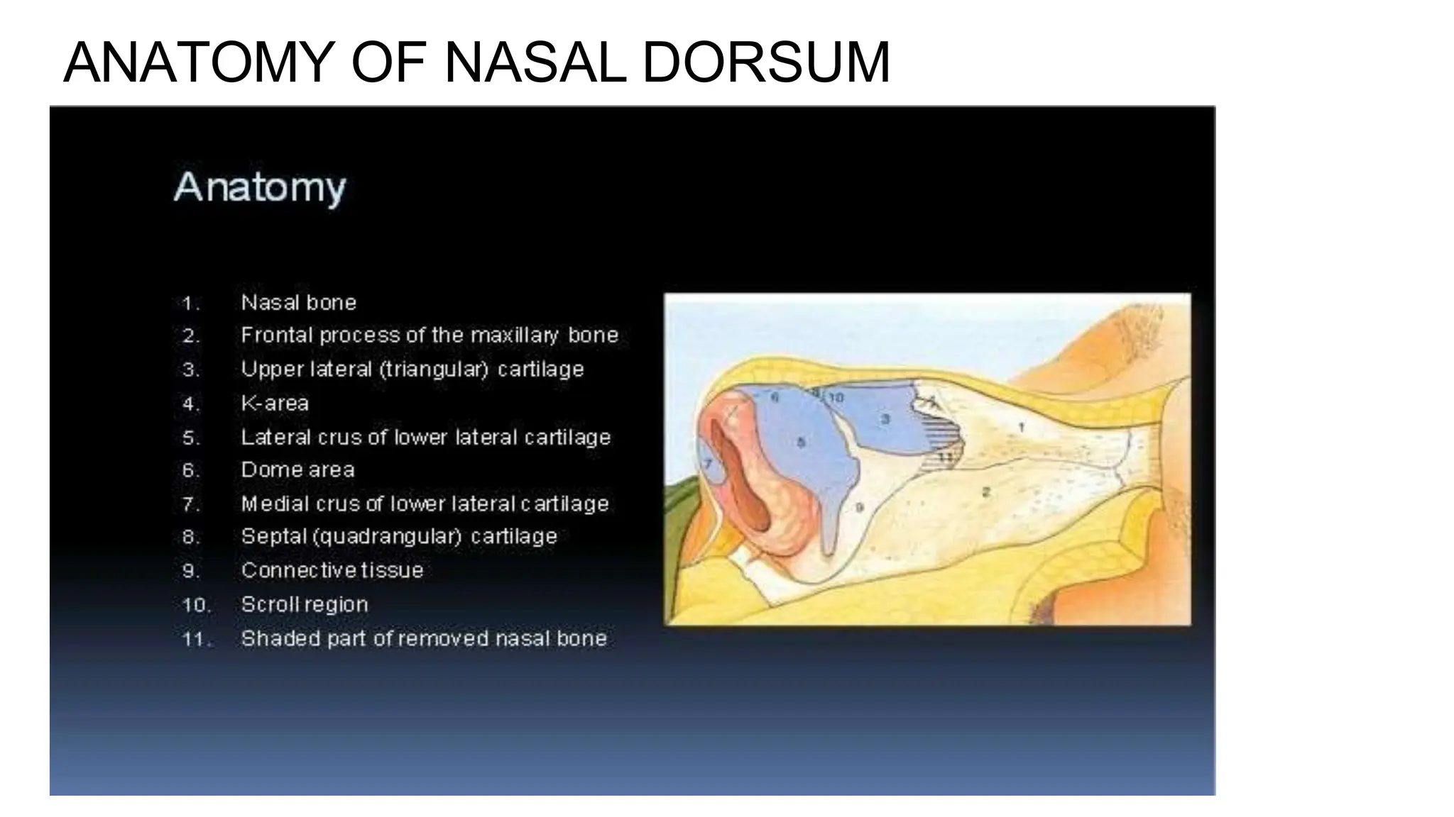 Dorsal reduction rhinoplasty by snehlata.pptx