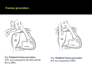 Dorv ppt | PPTX