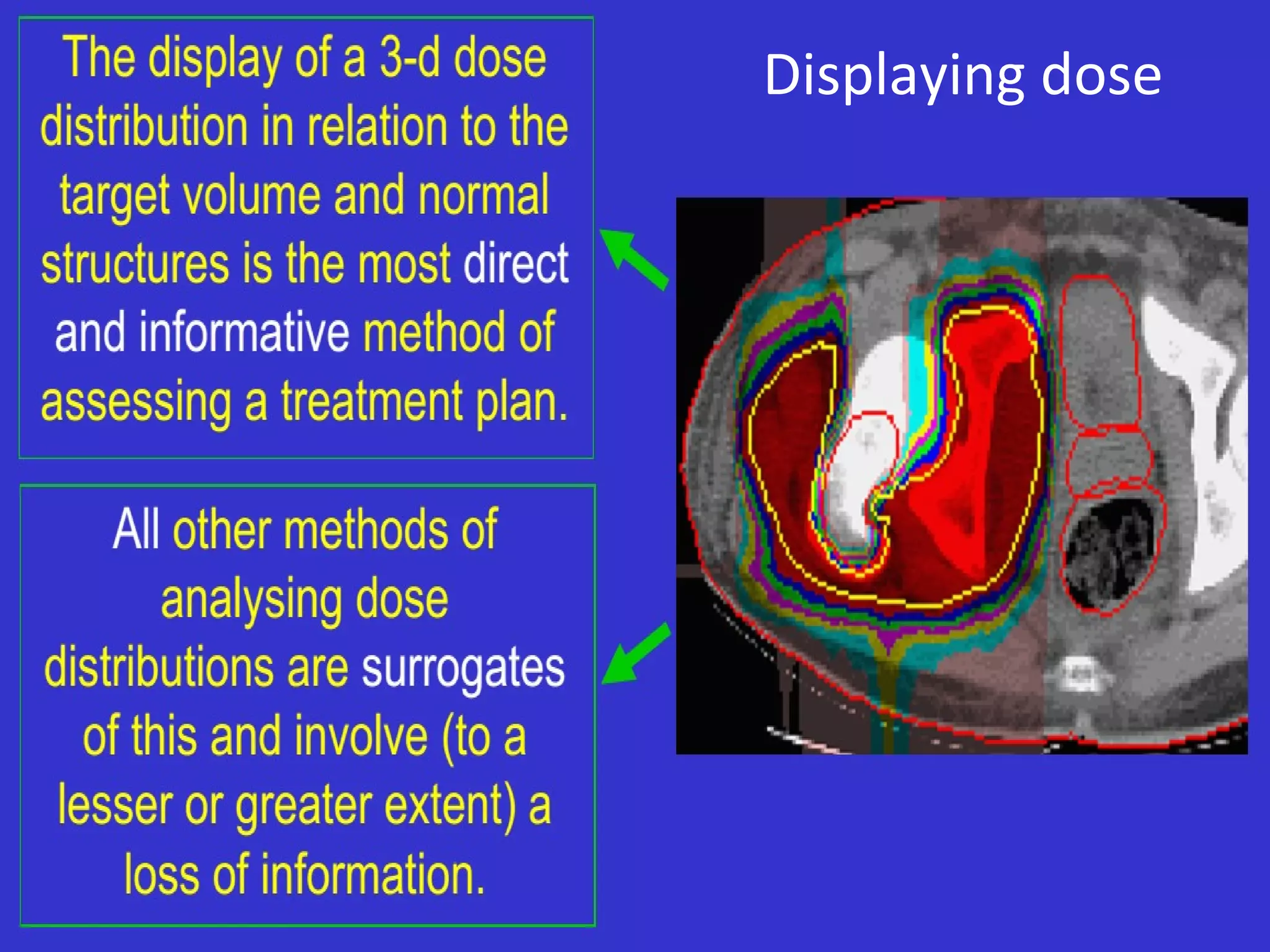 Dose volume histogram | PPT