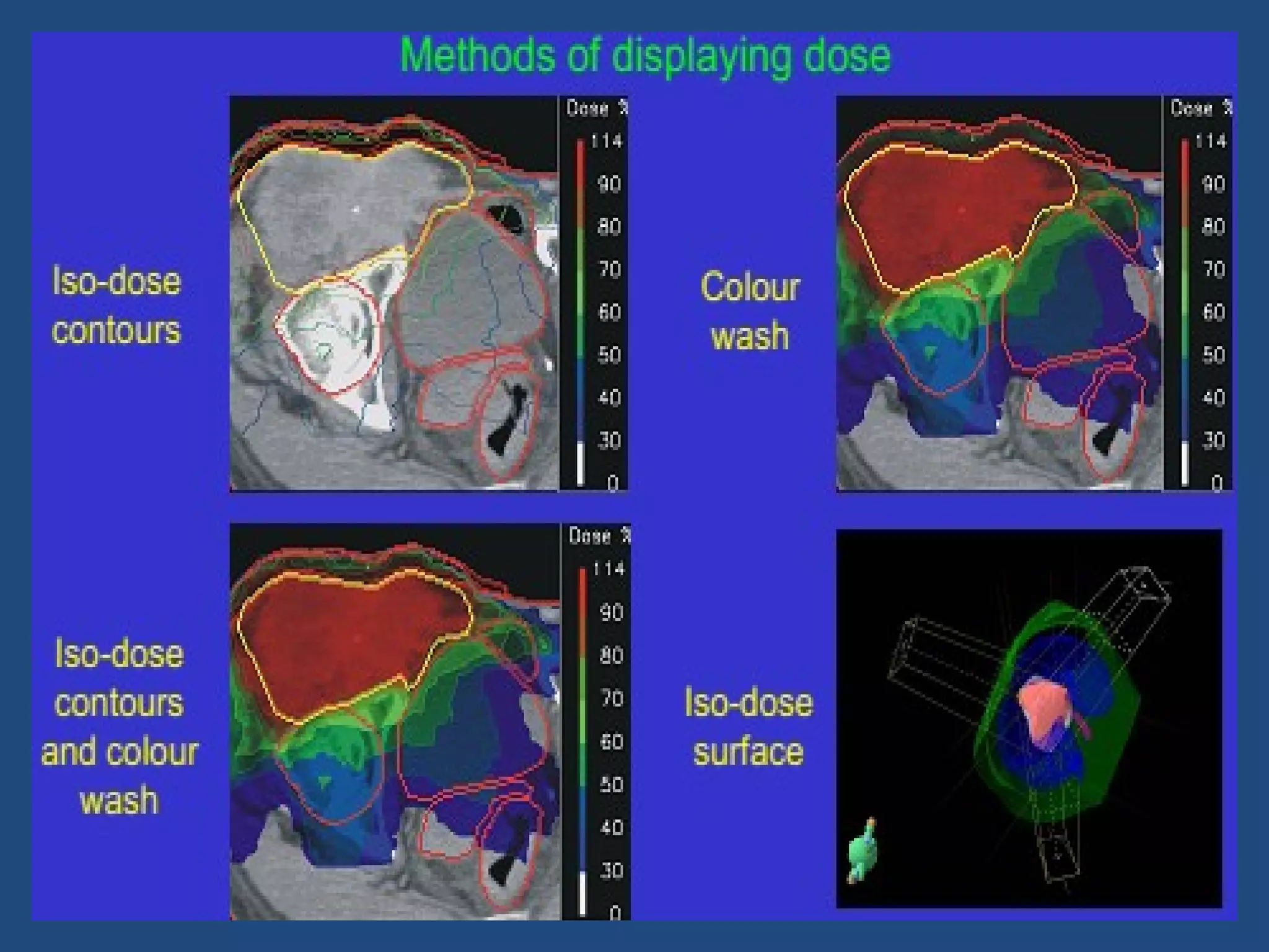 Dose volume histogram | PPT