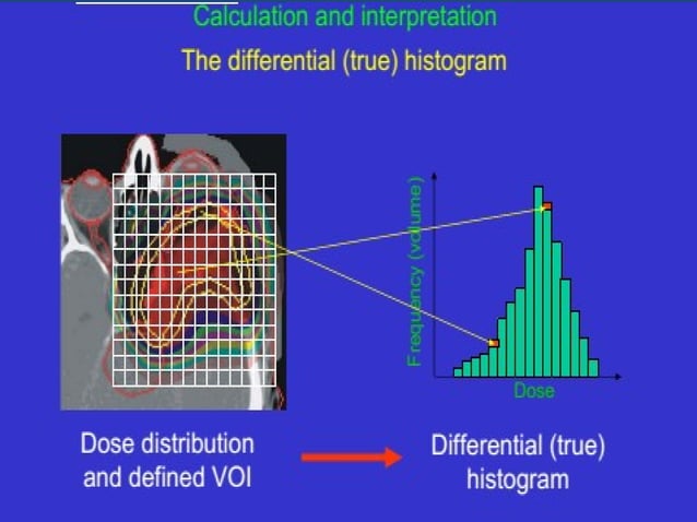 Dose volume histogram | PPT | 3-D Graphics | Computer Software and Applications