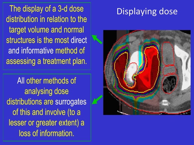 Dose volume histogram | PPT | 3-D Graphics | Computer Software and Applications