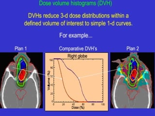 Dose volume histogram | PPT