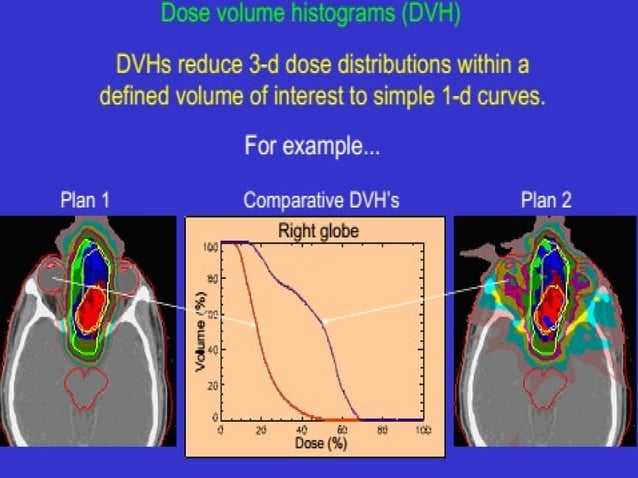Dose volume histogram | PPT | 3-D Graphics | Computer Software and Applications