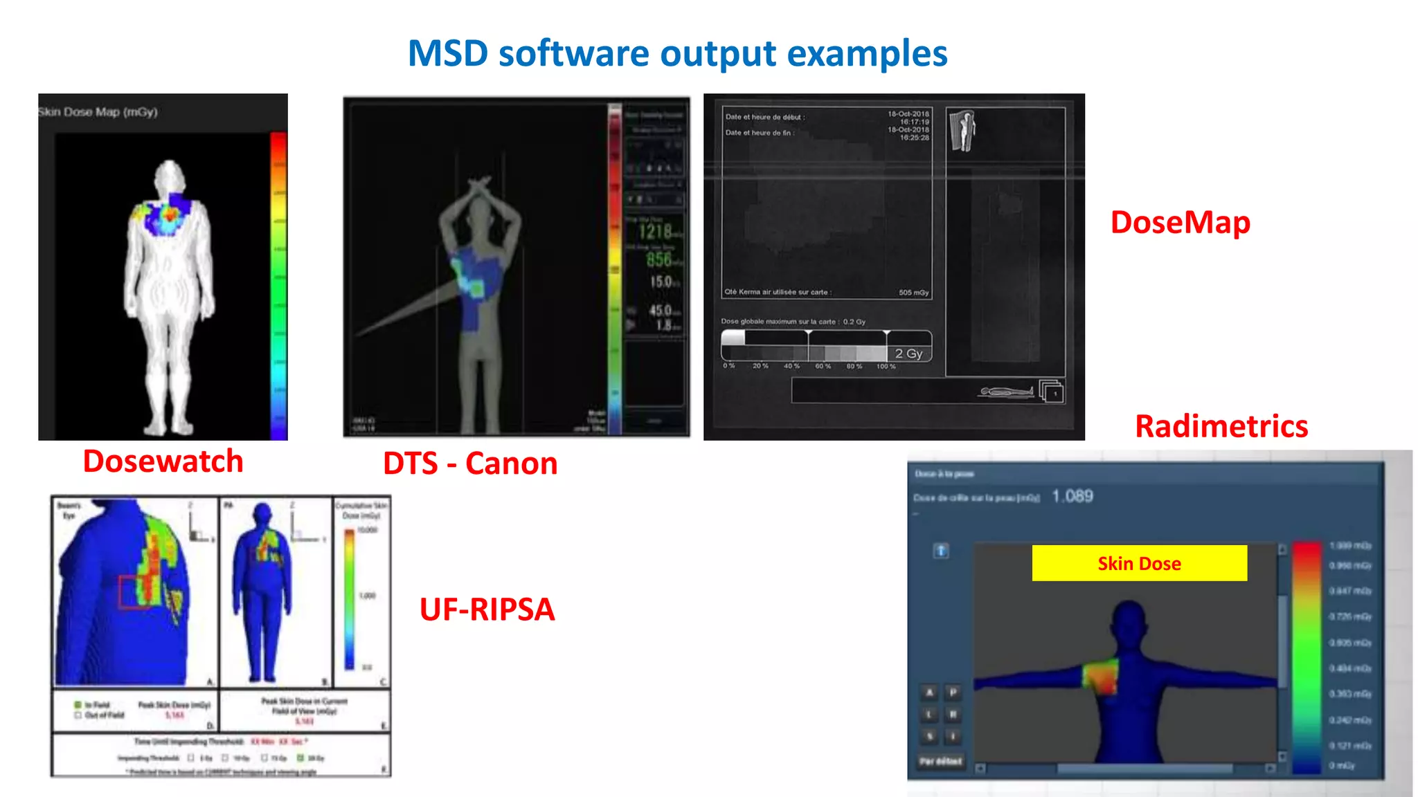 Radiation management in CTO PCI | PPTX