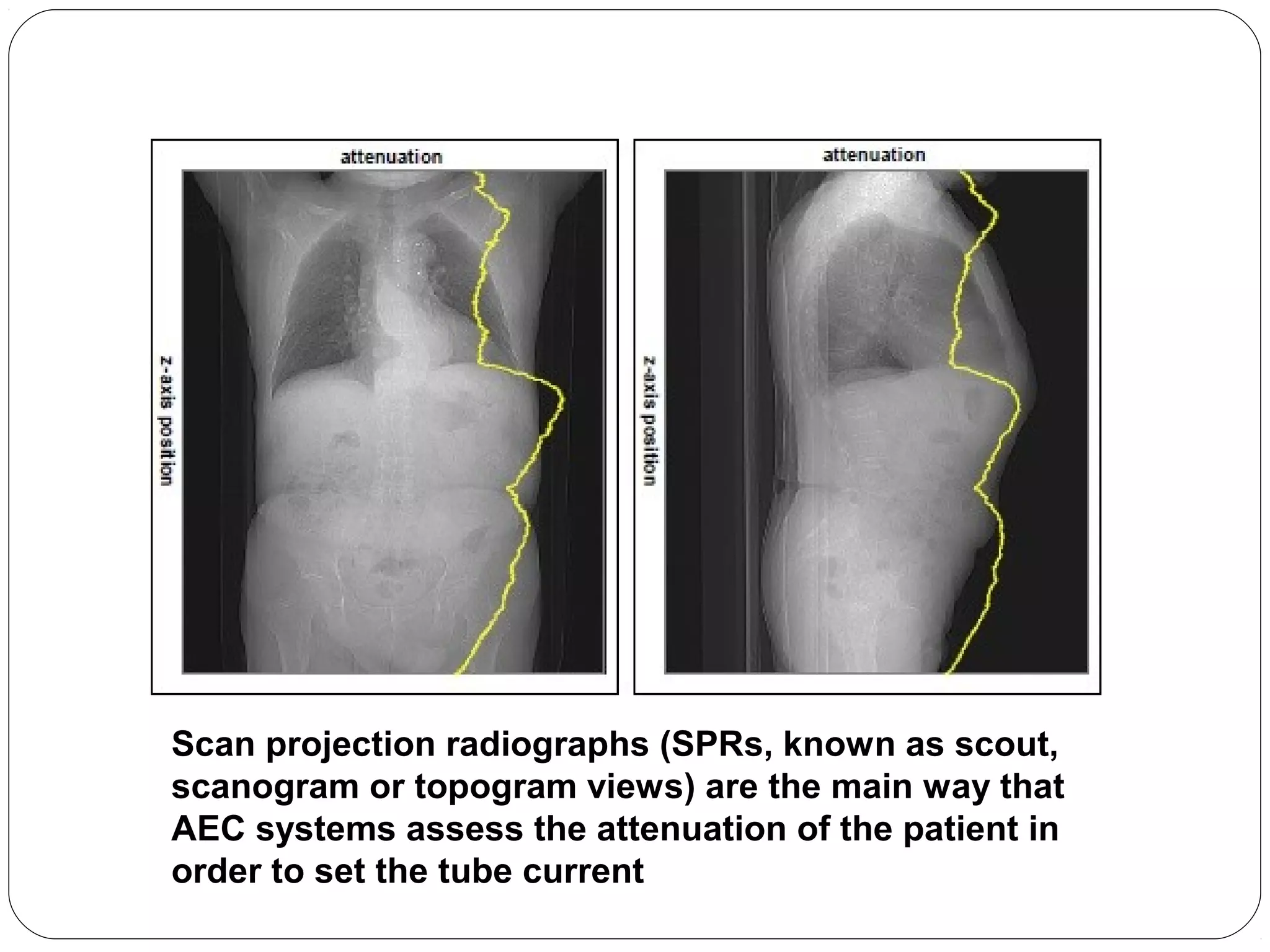 Dose reduction | PPT