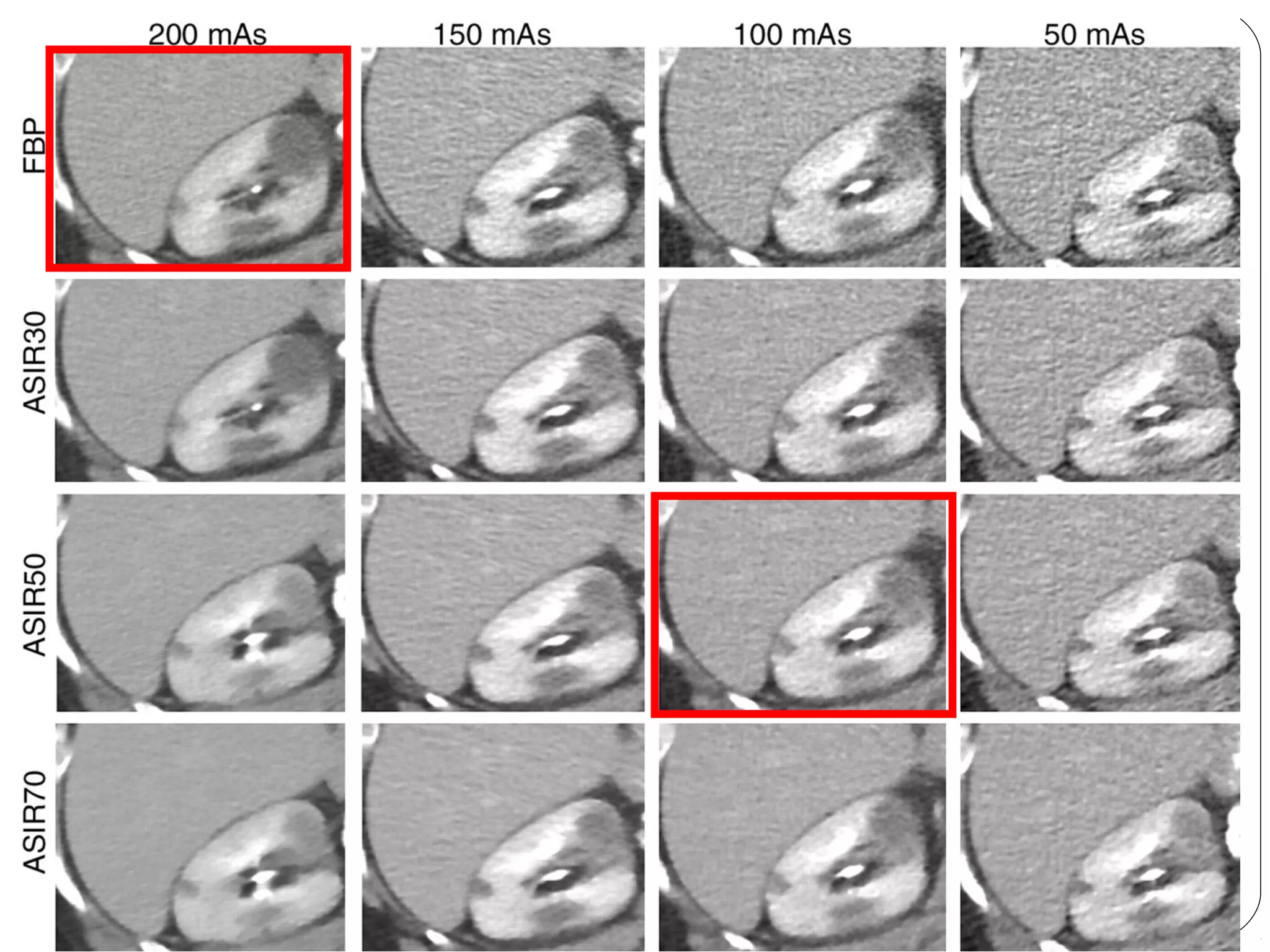 Dose reduction | PPT