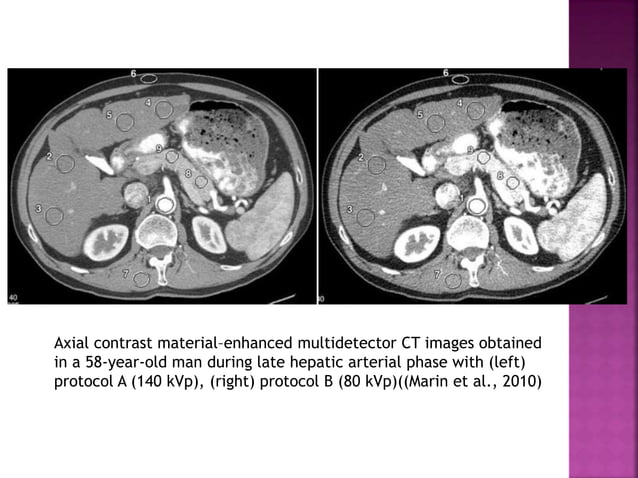 Dose Reduction Technique In Ct Scan Pptx Cameras And Camcorders