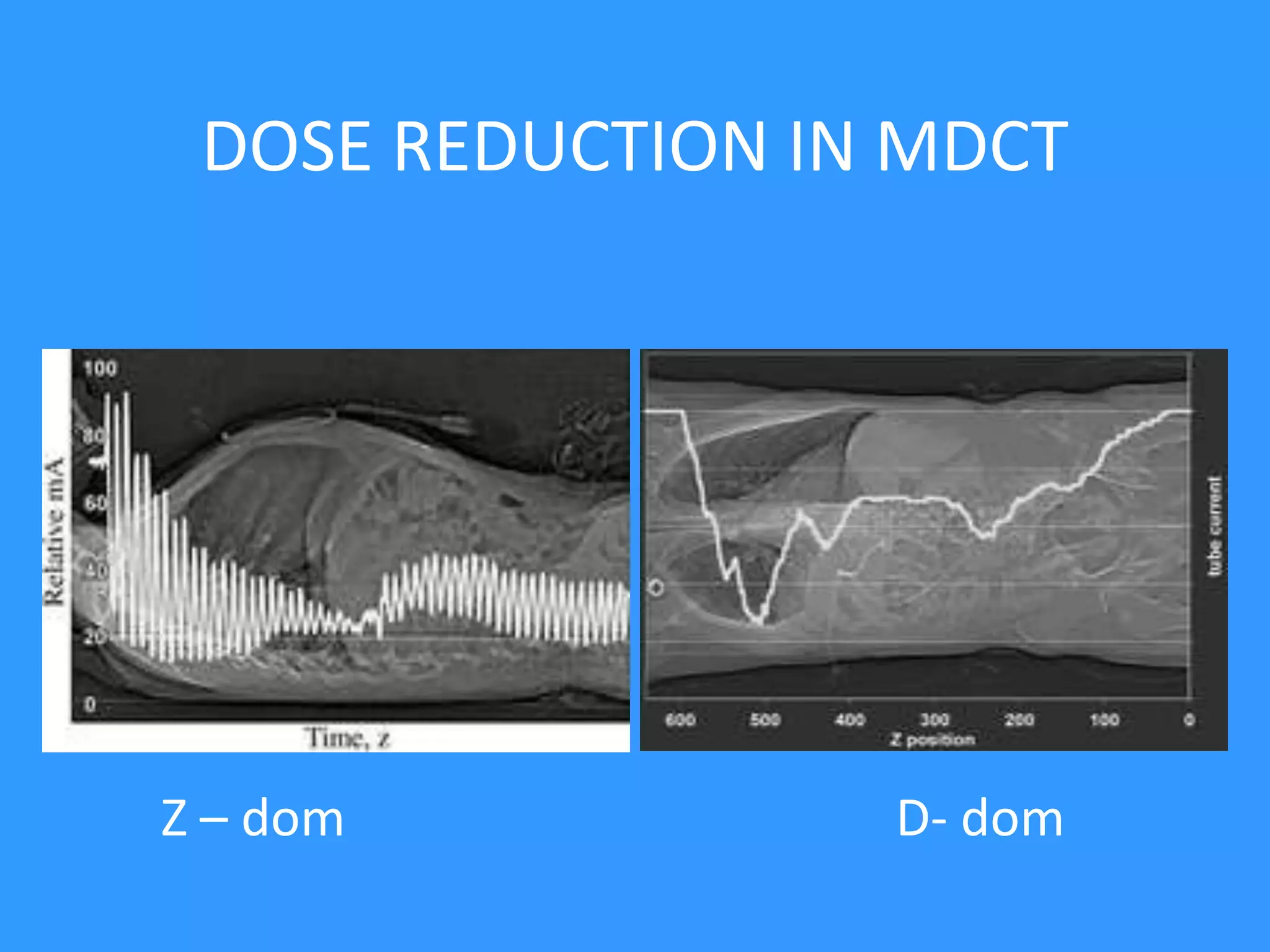 Dose reduction in MDCT . Daniel J.P , Khorfakhan hospital . UAE | PPT