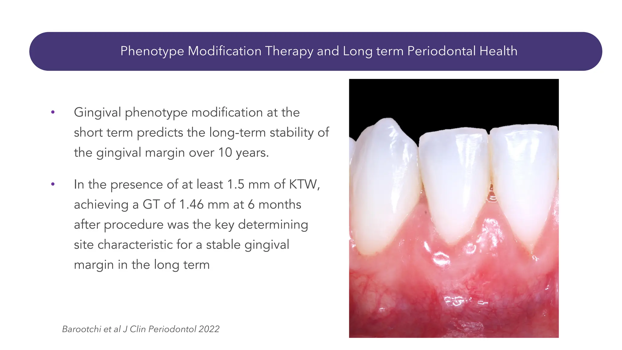 Periodontal/Peri-implant Soft tissue phenotype | PDF