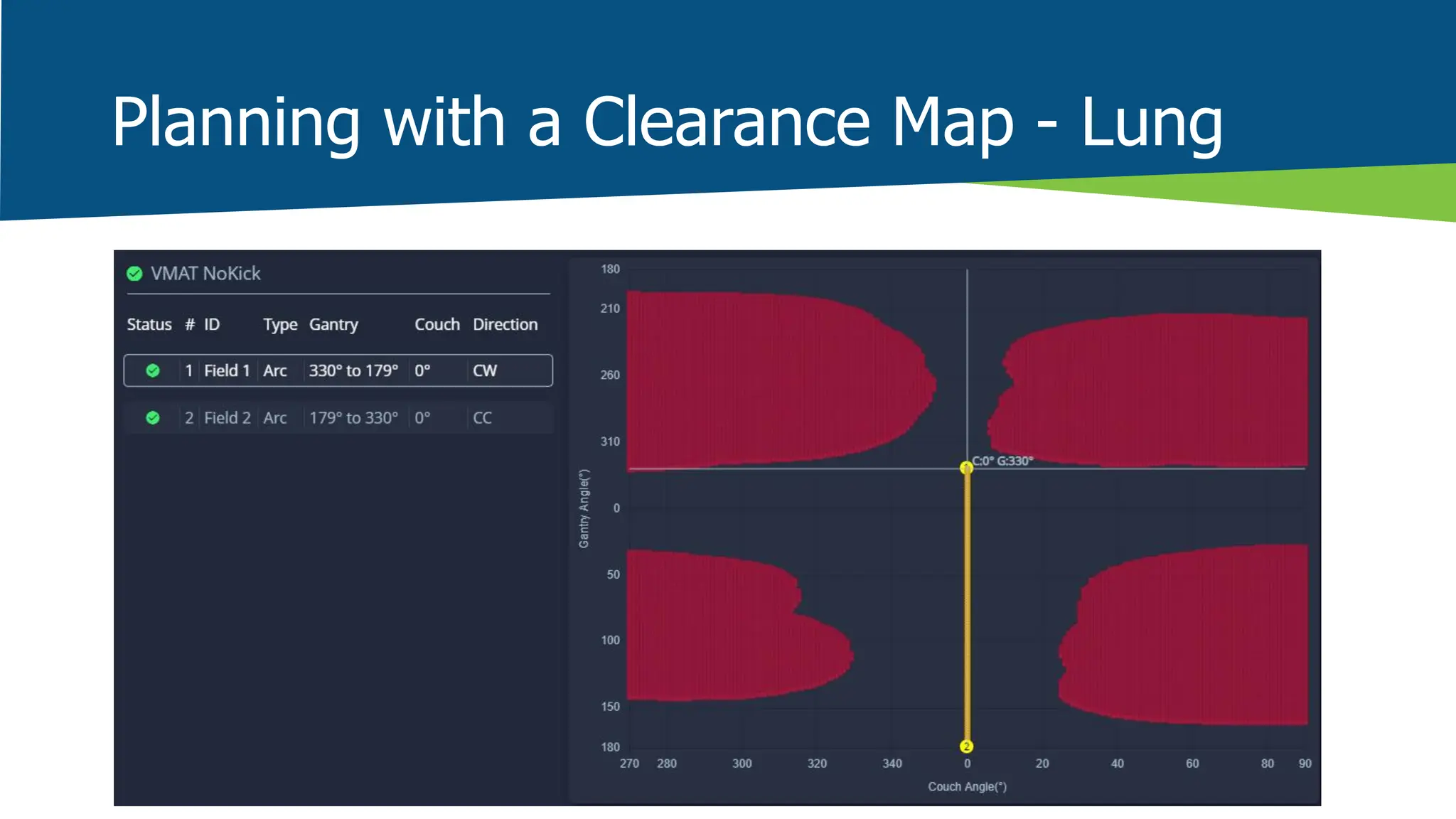 Dosimetric planning advantages of surface guided planning | PDF