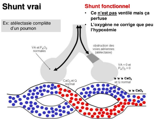 Doss 30 pac - conf TDP