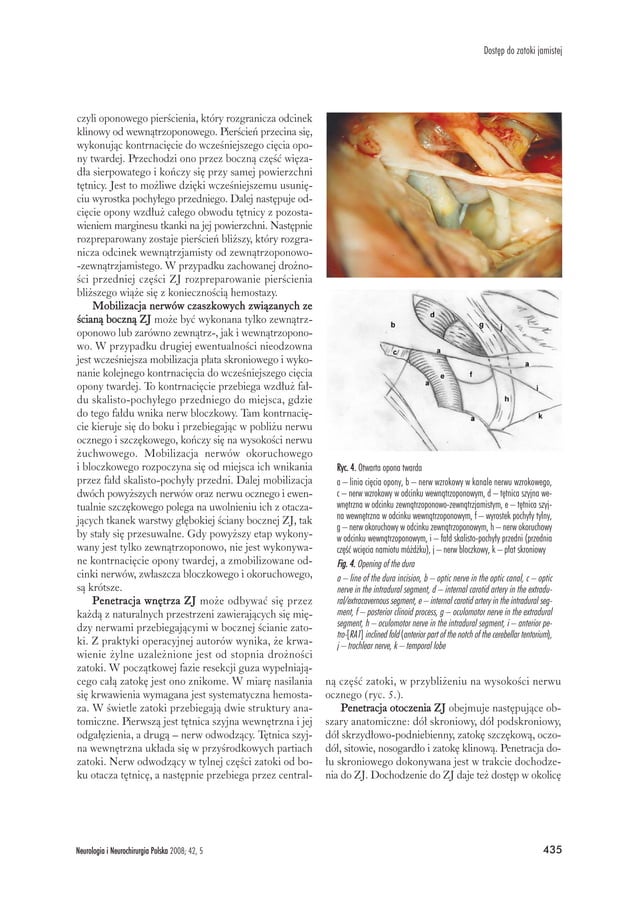 Lateral approach to the Cavernous sinus. | PDF