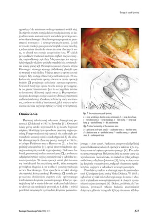 Lateral approach to the Cavernous sinus. | PDF