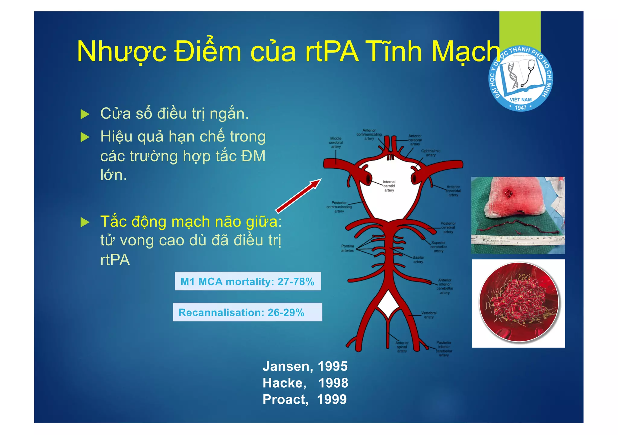 Đột quỵ - Đại học Y dược TPHCM | PDF