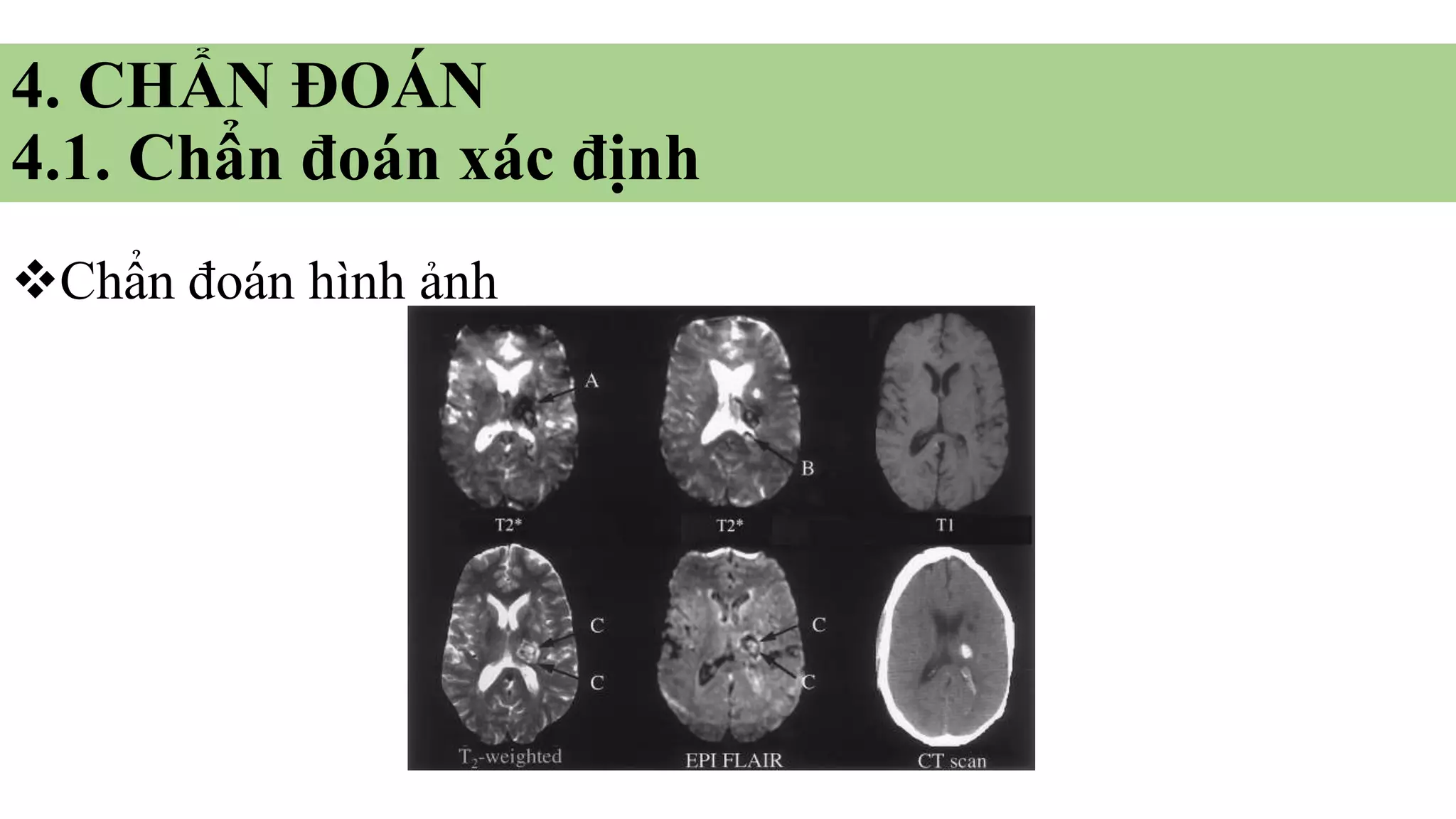 Dot quy chay mau nao cme 2020 - ts do duc thuan | PPT