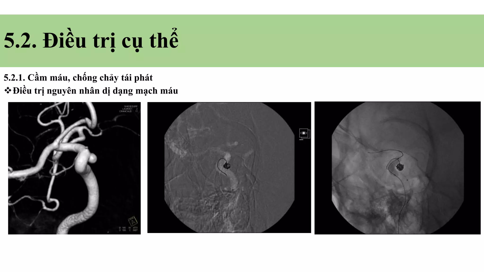 Dot quy chay mau nao cme 2020 - ts do duc thuan | PPT