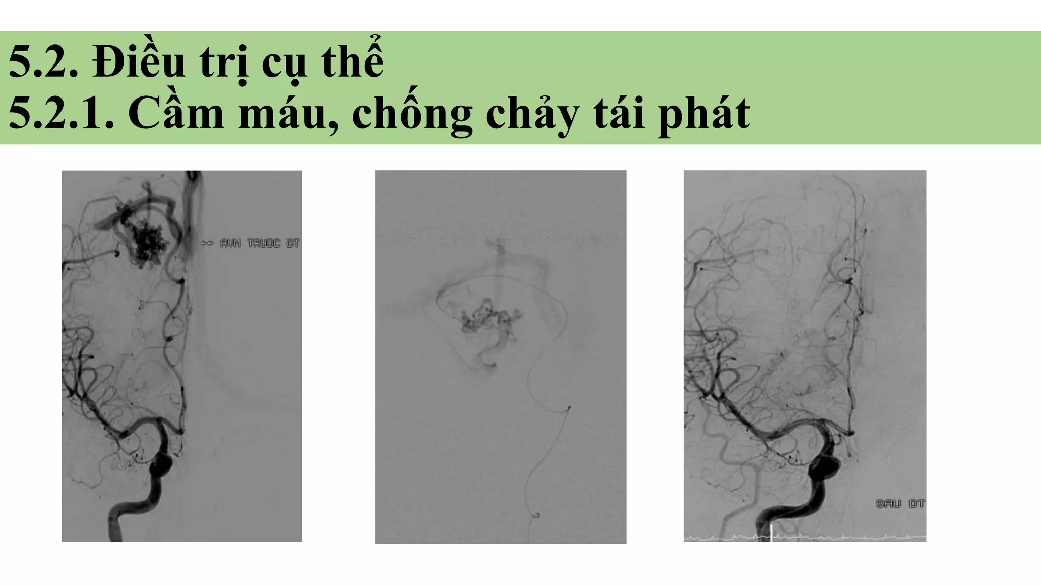 Dot quy chay mau nao cme 2020 - ts do duc thuan | PPT
