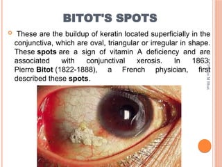 Dots spots lines_and_rings_in_ophthalmology | PDF