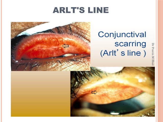 Dots spots lines_and_rings_in_ophthalmology | PDF | Eye and Vision ...