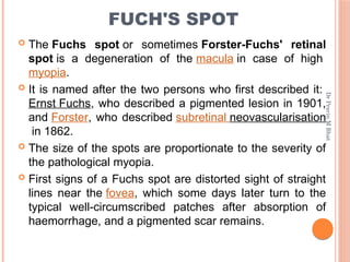 Dots spots lines_and_rings_in_ophthalmology | PPT