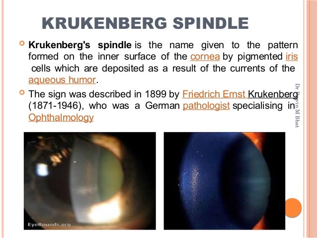Dots spots lines_and_rings_in_ophthalmology