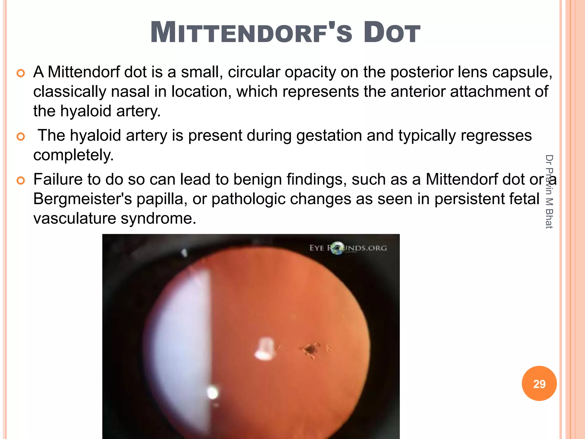 Dots spots lines and rings in ophthalmology | PPTX