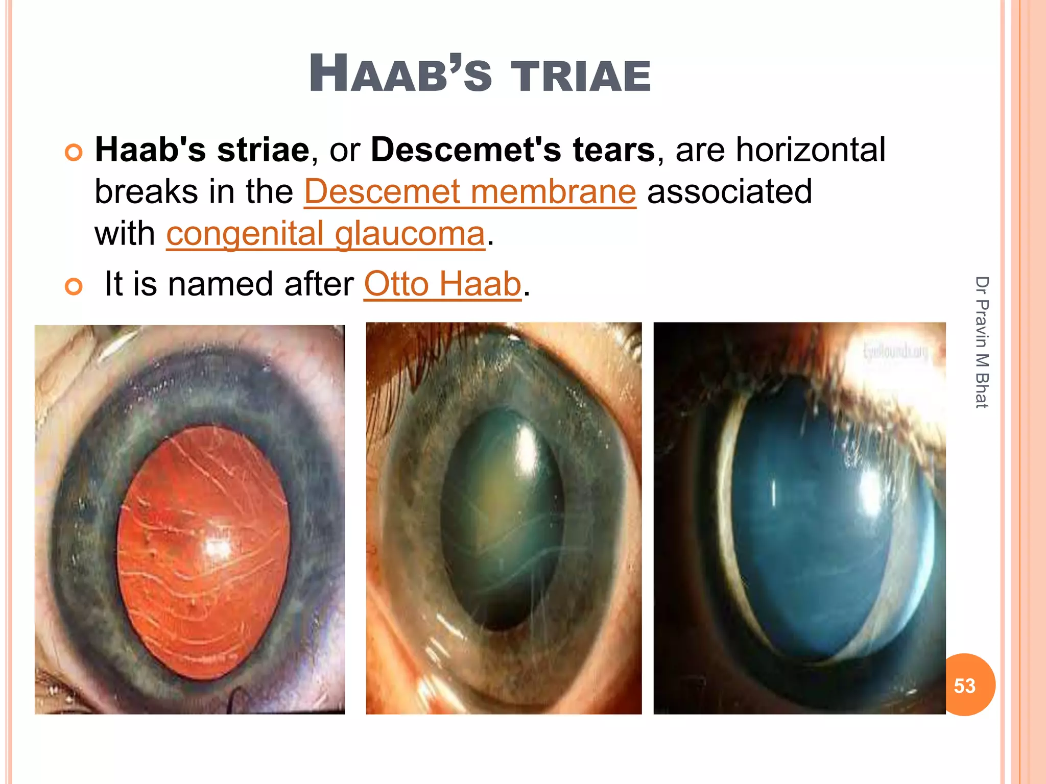 Dots spots lines and rings in ophthalmology | PPTX