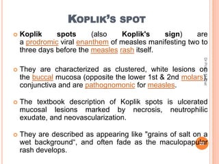 Dots spots lines and rings in ophthalmology | PPTX
