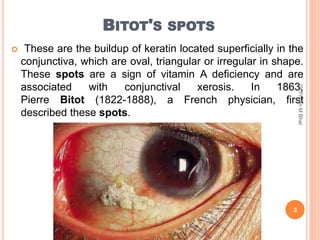 Dots spots lines and rings in ophthalmology | PPTX
