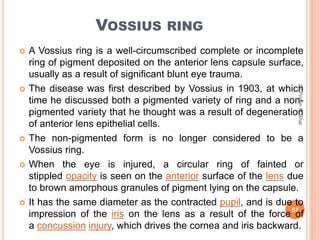 Dots spots lines and rings in ophthalmology | PPTX